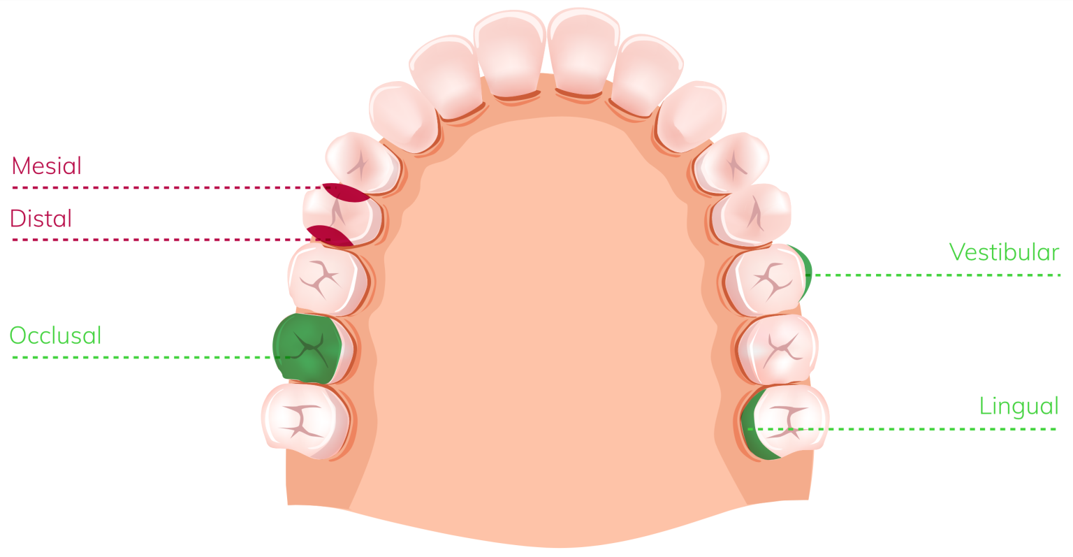 Mouth conditions – Interprox